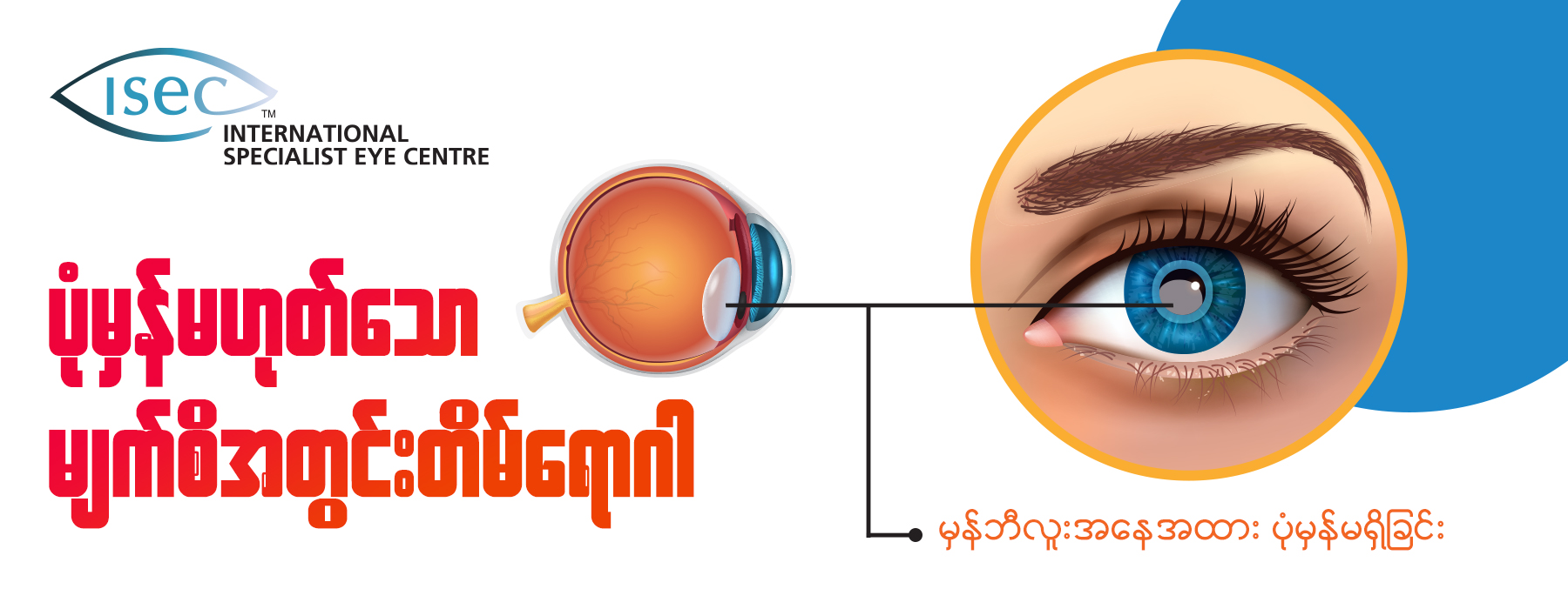 ISEC Eye Centre Myanmar |Home - ISEC Eye Centre Myanmar