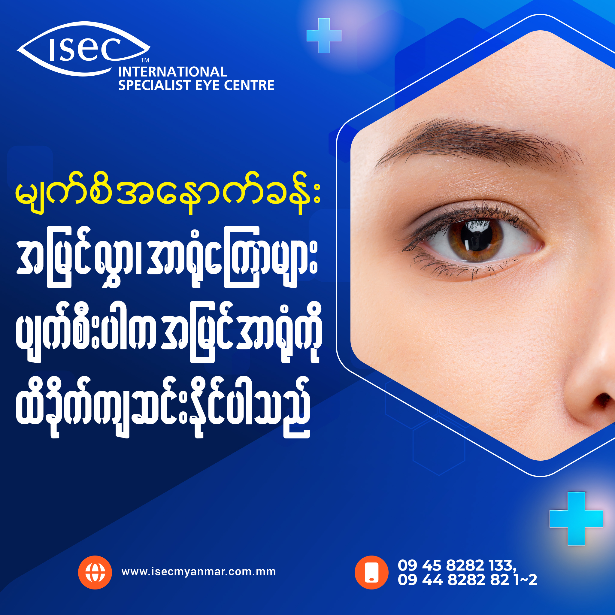ISEC Eye Centre Myanmar |မျက်စိအနောက်ခန်းအမြင်လွှာပြဿနာများဖြစ်နေပြီလား ...